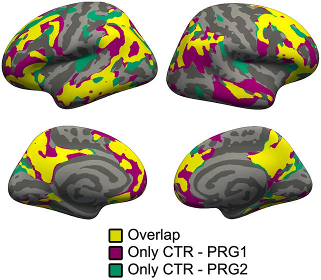 Second pregnancy does something unique to the brain, study reveals