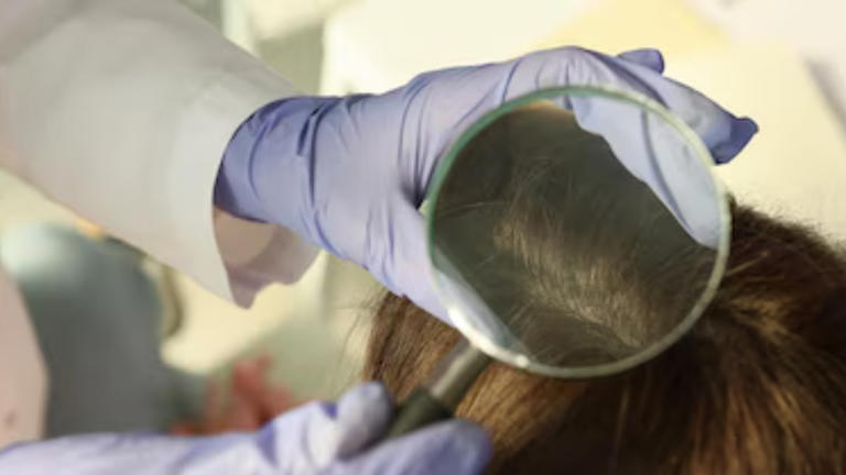 Scientists grow fully working hair follicles in a lab for 1st time