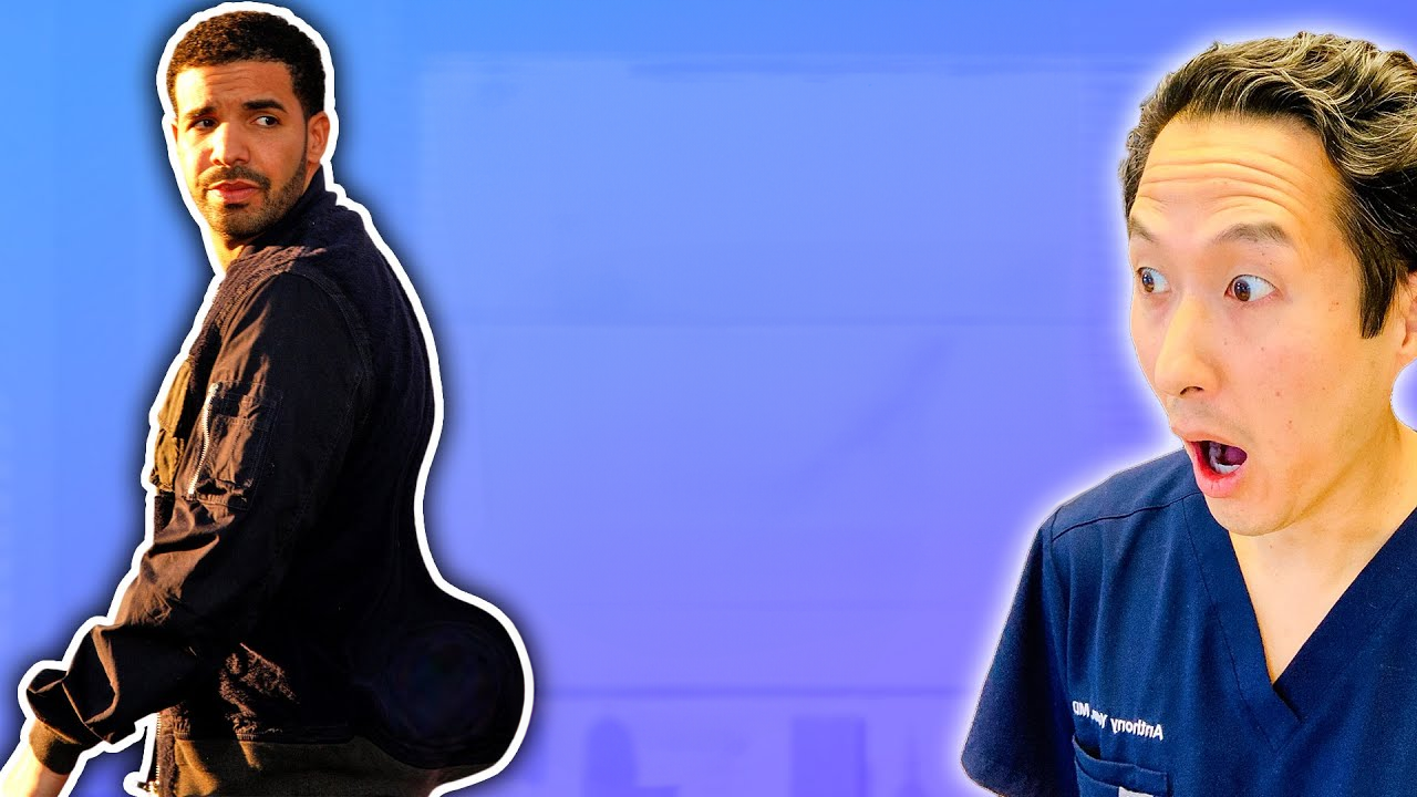 Drake’s surgery transformation revealed