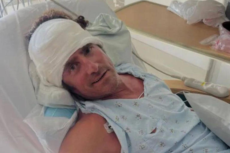 Dr Brian Herman dead: Real Housewives star dies aged 63 after brain ...