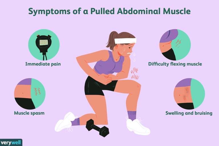 How to treat a pulled abdominal muscle