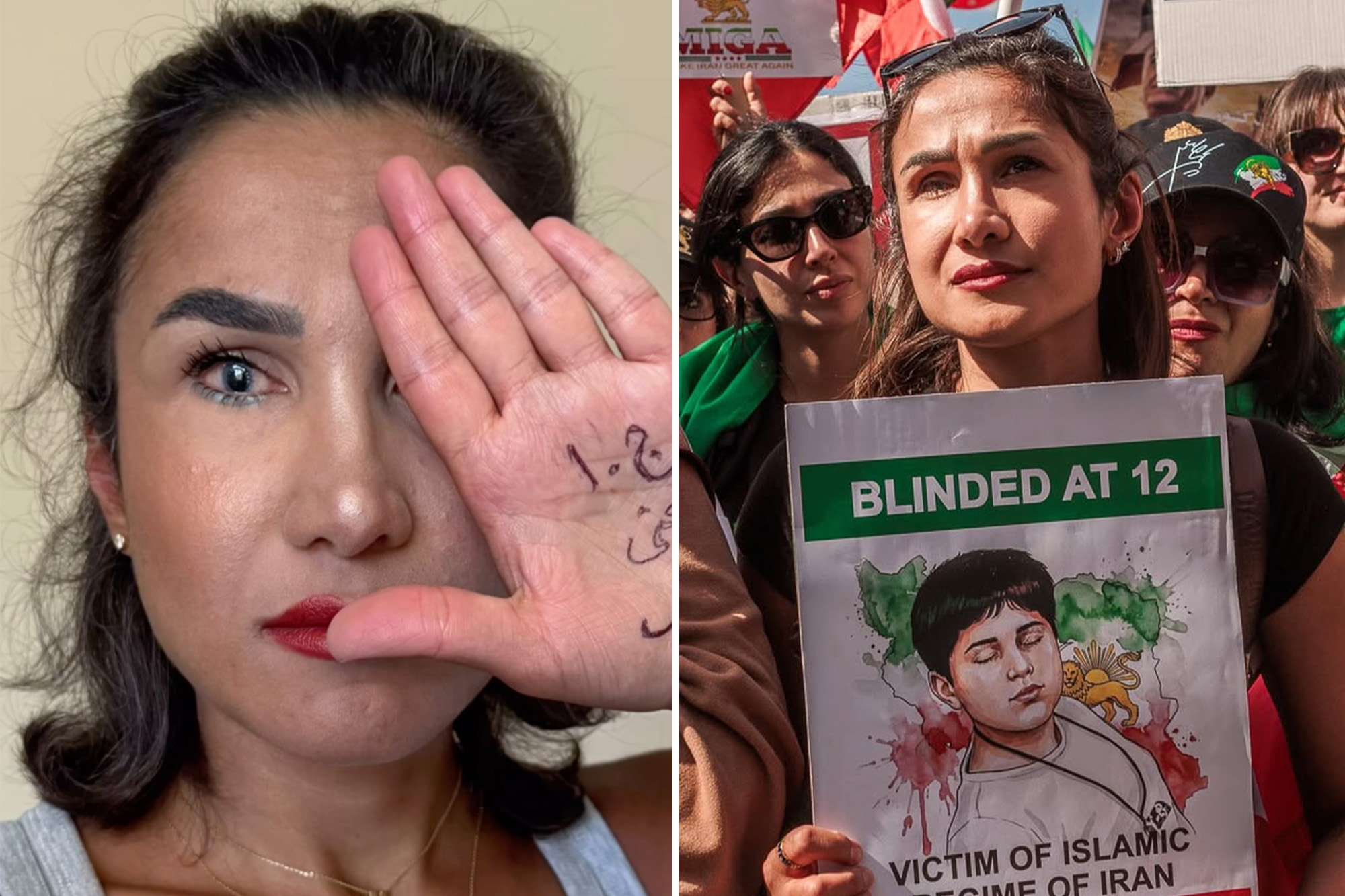 Iranian woman who lost her eye after being shot by the Revolutionary ...