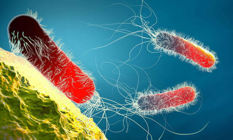 Expert names six symptoms of deadly sepsis, from discoloured skin to ...