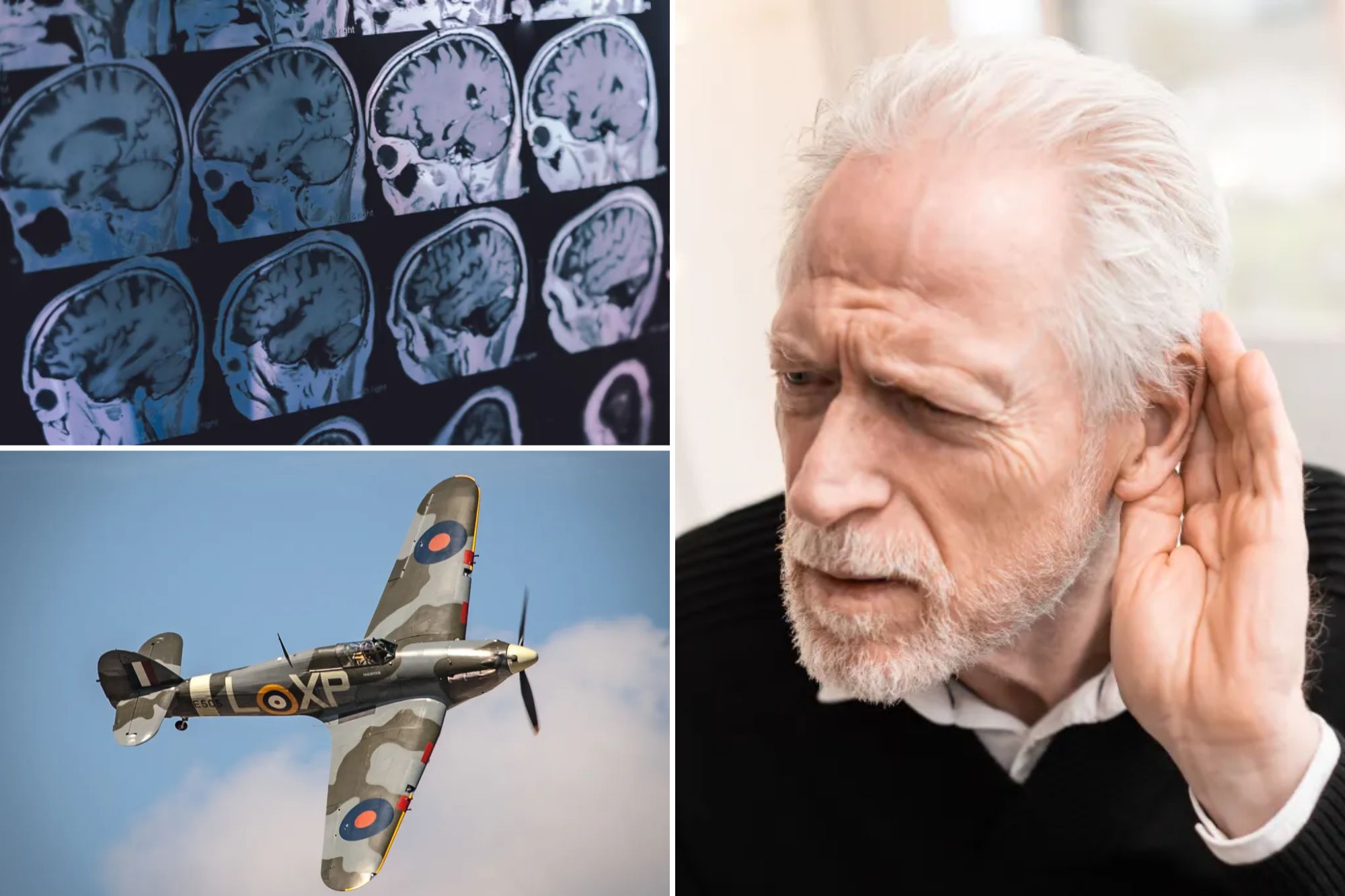Rare type of dementia makes man cry happy tears for bizarre reason ...