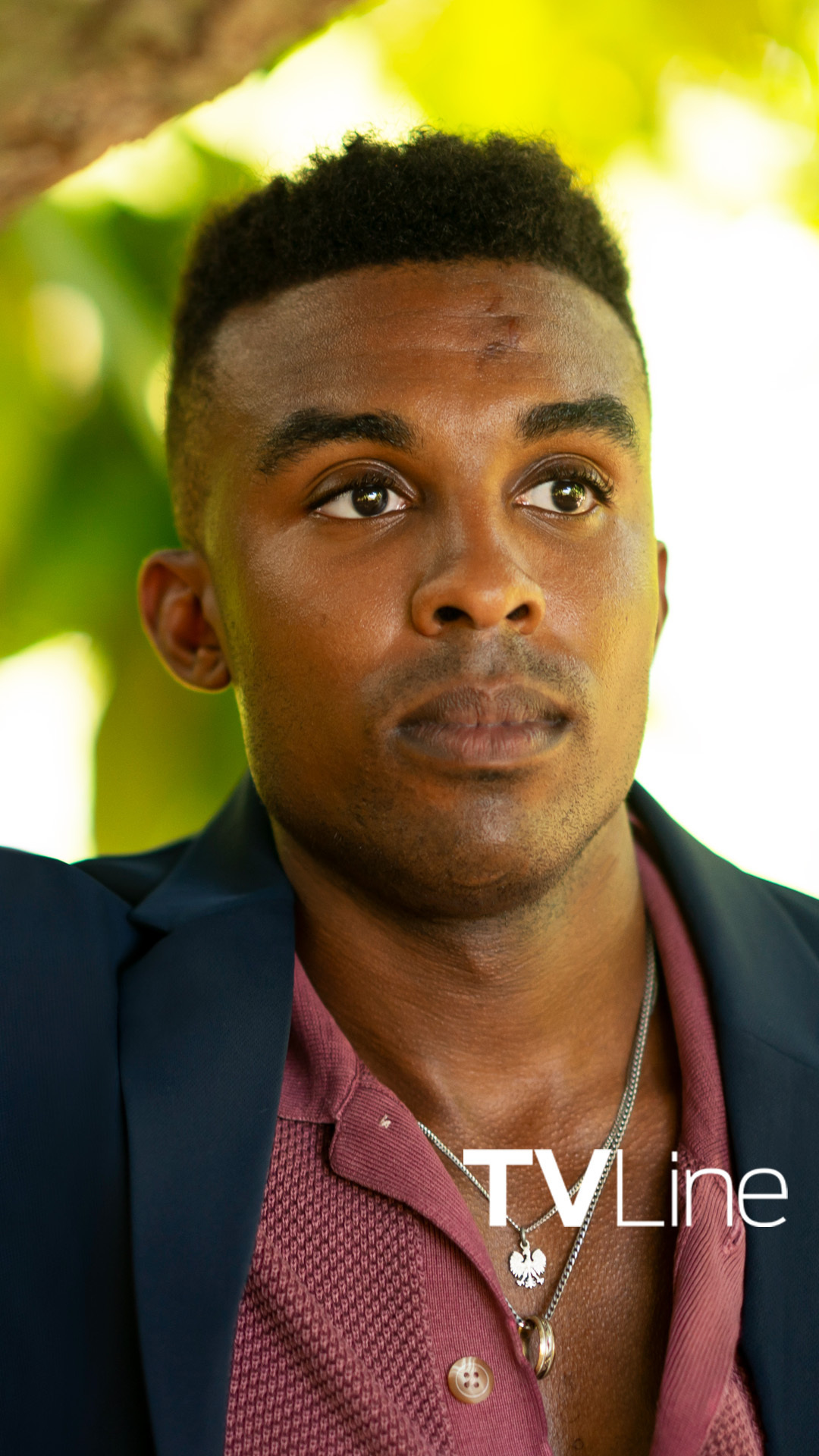 Survivor 50 | Kyle Fraser reveals what you didn't see about his injury ...