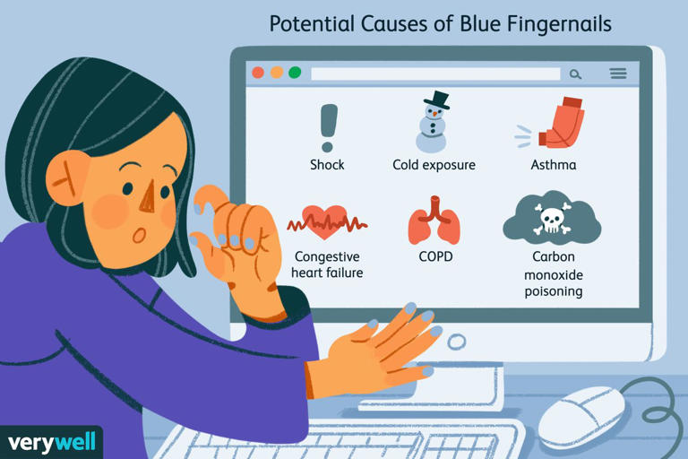Causes of blue or purple nails and when to seek help