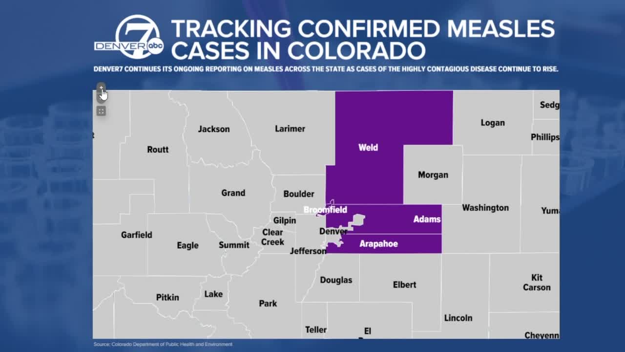Four more measles cases identified in the Denver metro
