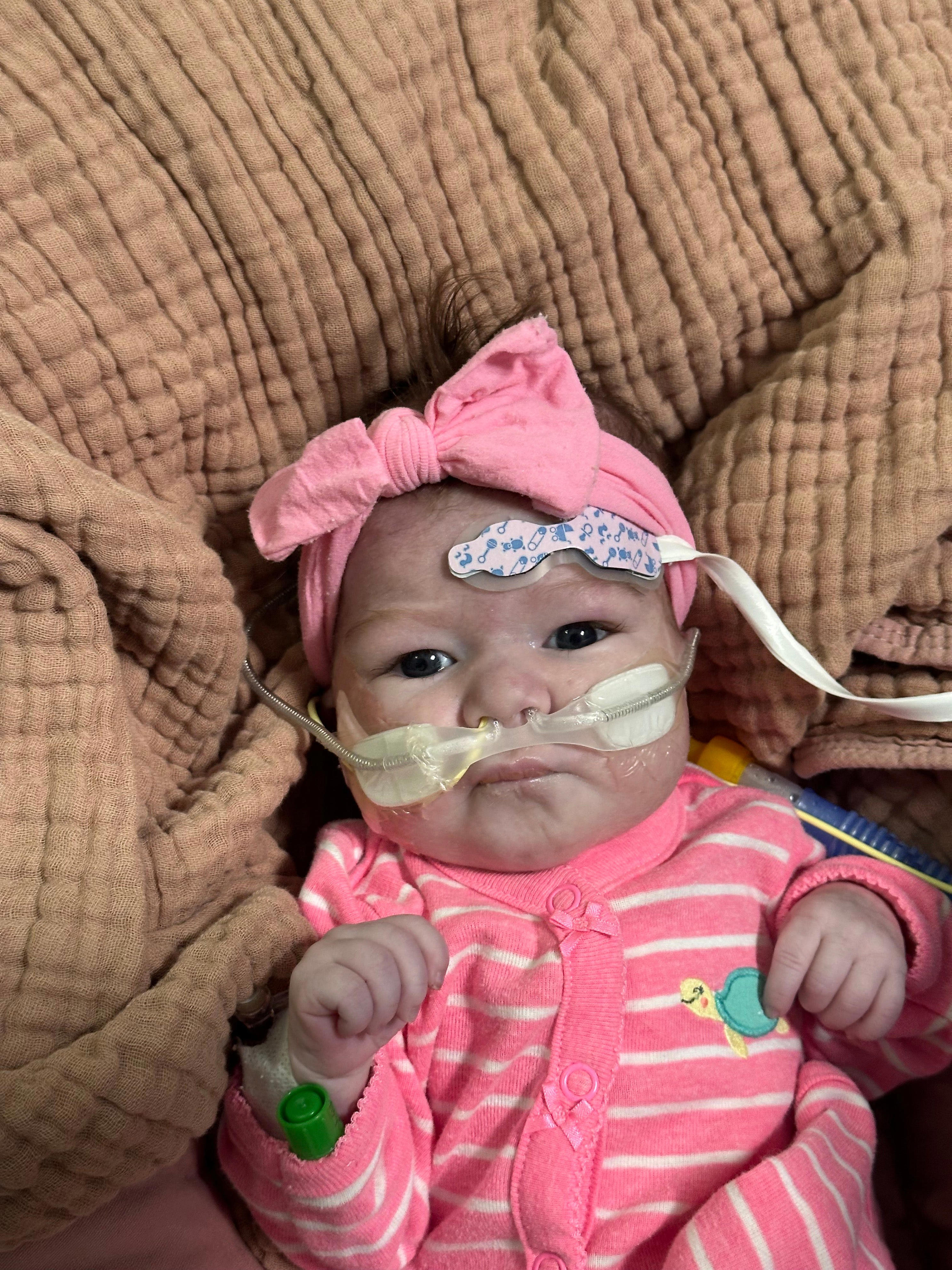 Baby Mabel Rose breathes on her own as she waits for a new heart