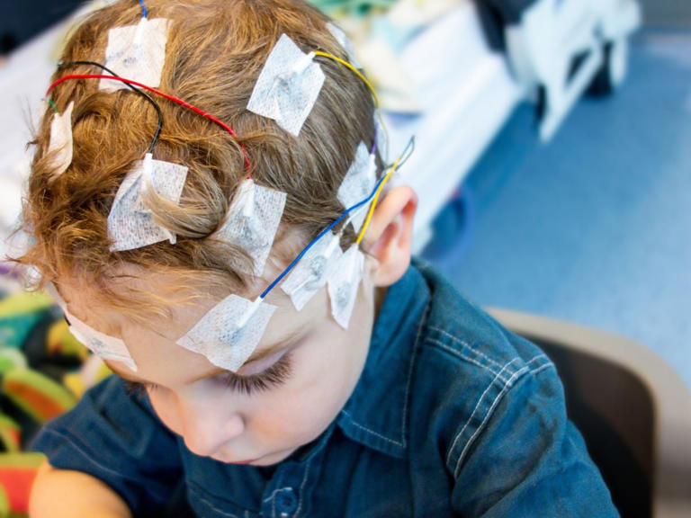 Zorevunersen: el tratamiento que podría reducir convulsiones en niños ...