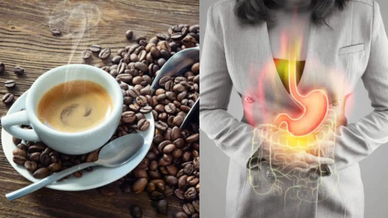 Does coffee cause acid reflux? Why your morning cup triggers heartburn