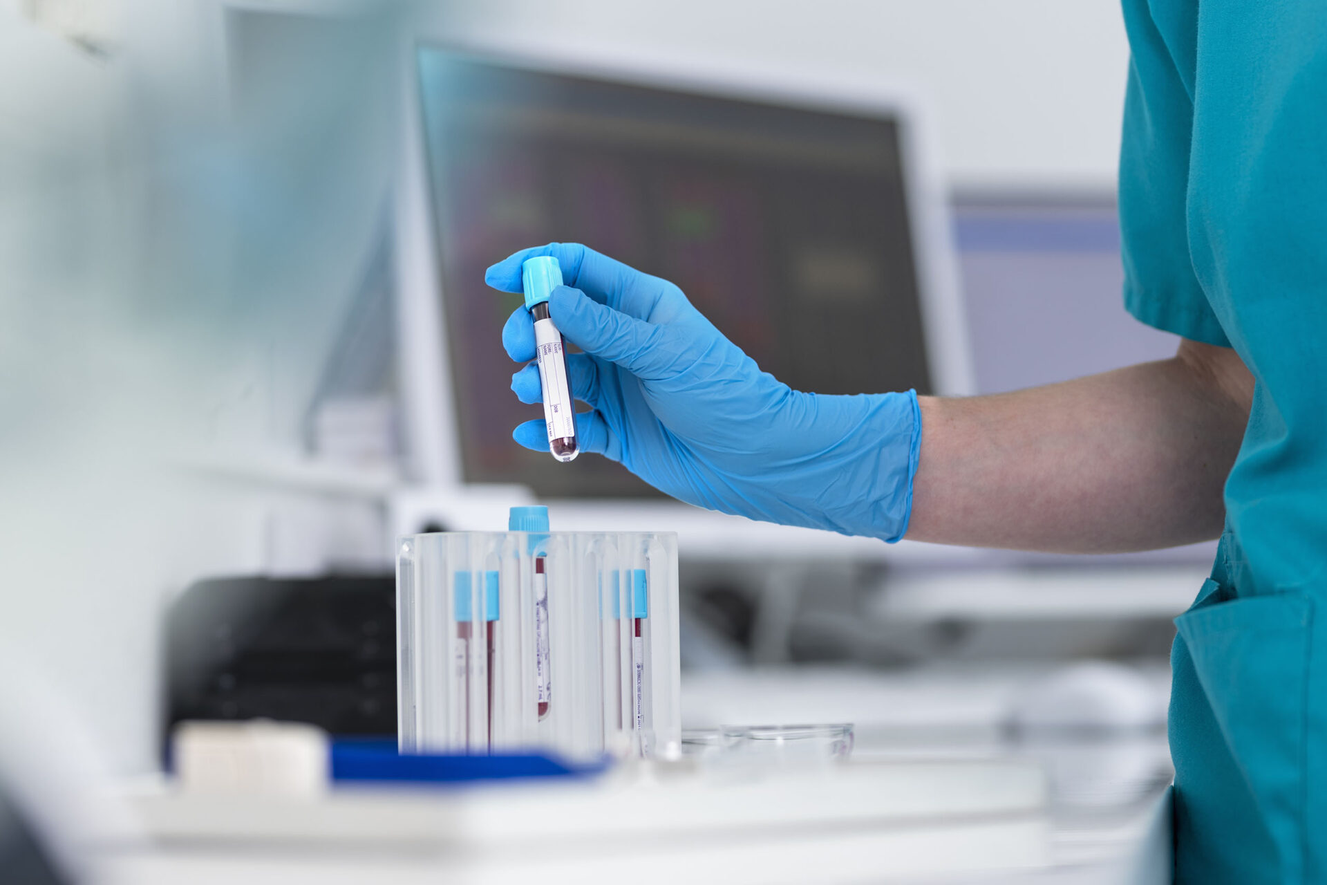 Qual será nossa expectativa de vida após os 70 anos? Um exame de sangue ...