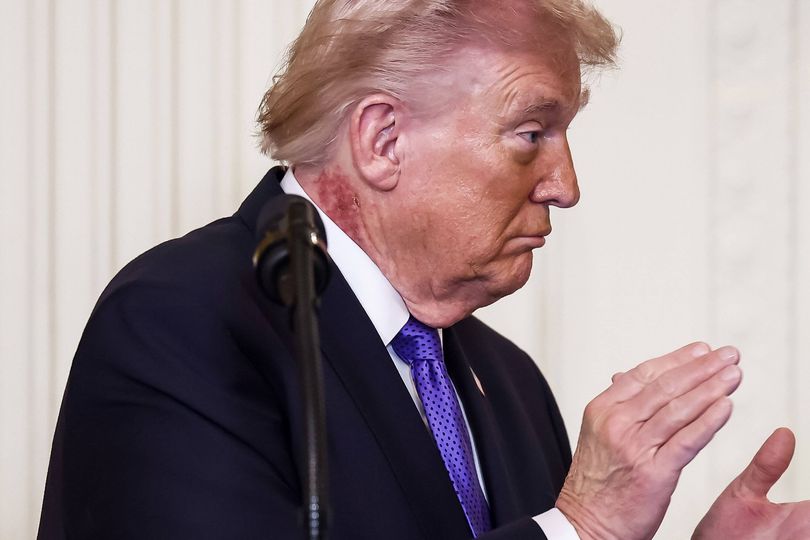 CNN issues alert as White House doctor addresses President Trump's ...