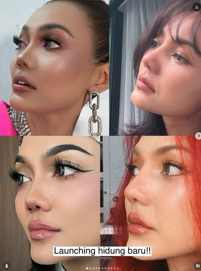 Profil Rina Nose, artis yang putuskan oplas hidung dengan dokter Tompi ...