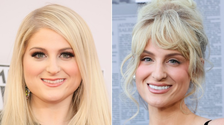 Side-by-side pics put Meghan Trainor's 'Ozempic face' on full display