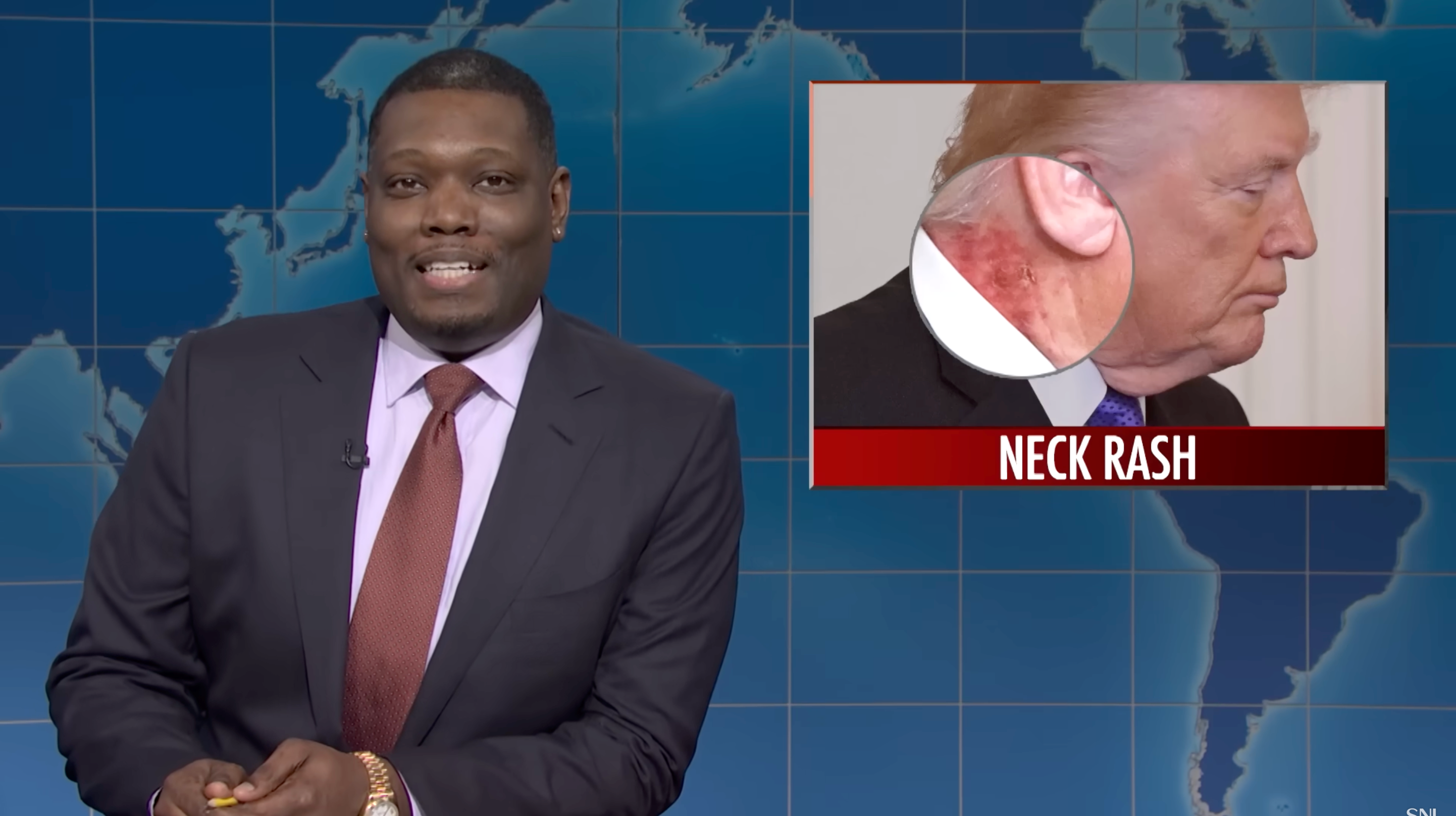 'Weekend Update' names the reason for Trump's neck rash... and holy moly