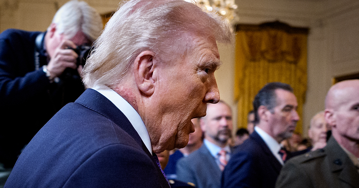 Frank’s sign on Trump’s ear could be huge indicator of potentially ...