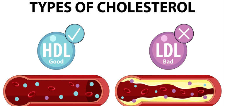 How to increase HDL cholesterol naturally?
