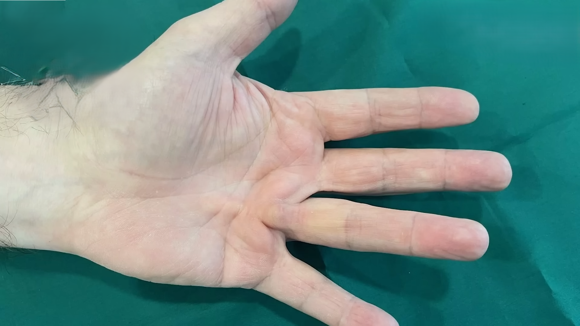 Look at your nails, skin, and breath… your liver might be in trouble