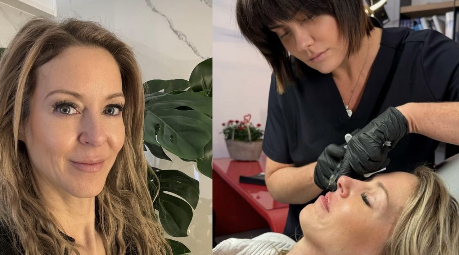 Beauty-Beichte! Das hat Simone Lugner machen lassen