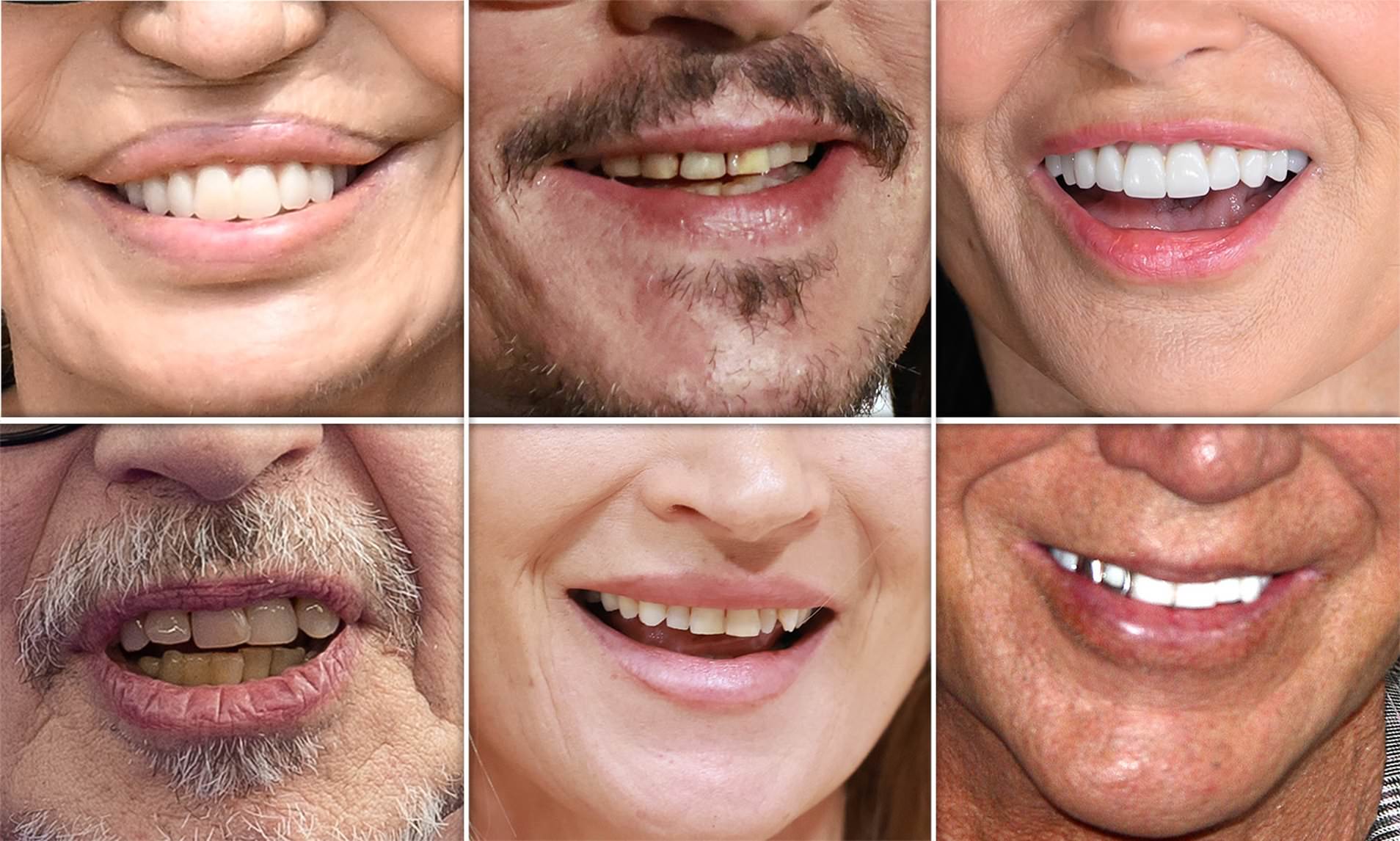 Experts reveal what perfect teeth look like - and which stars could do ...