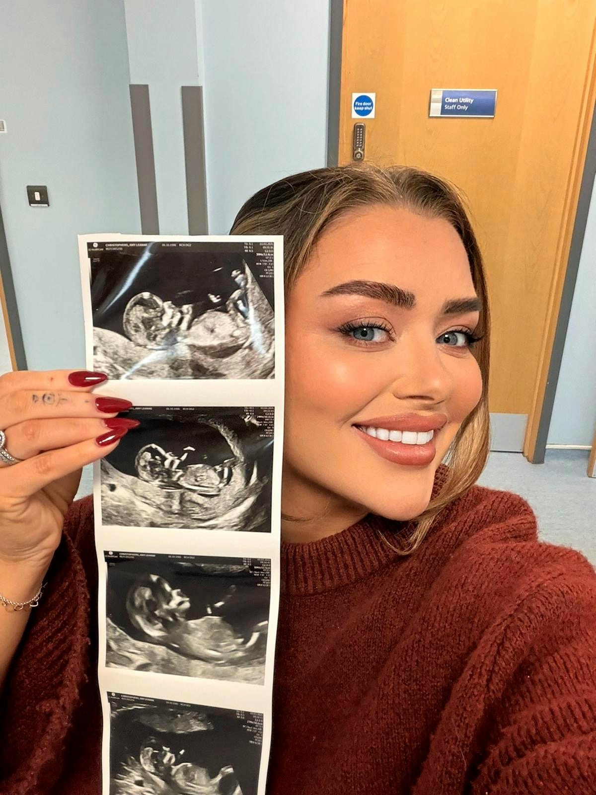 MAFS UK’s Amy Christophers: ‘I fell pregnant after eight weeks of dating’