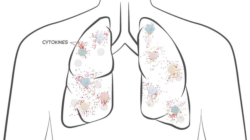 The deadliest pandemic of the 20th century explained