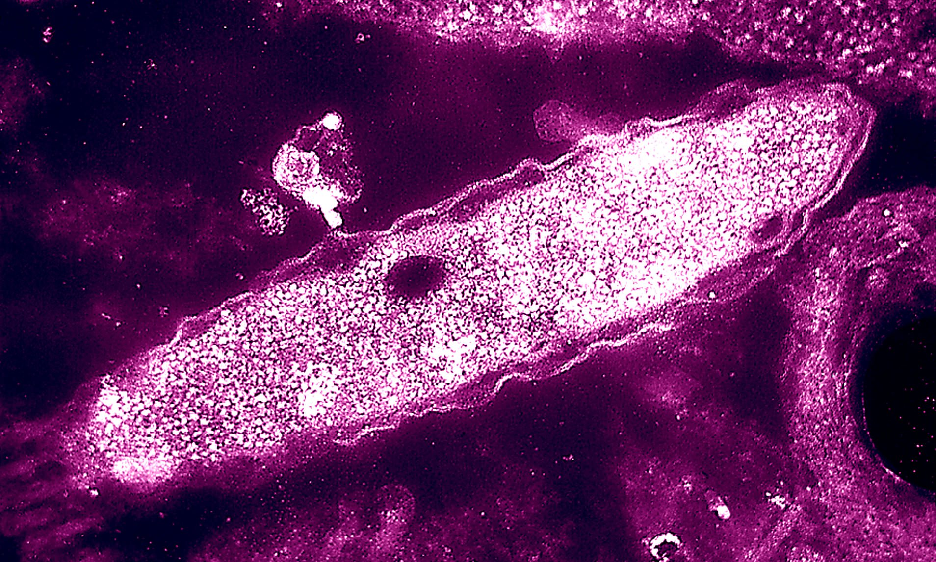 Legionnaires' disease warning: Health chiefs investigating spike of ...