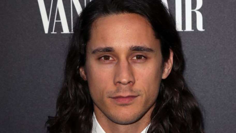 Netflix casts Yellowjackets star as Shanks in live-action One Piece show