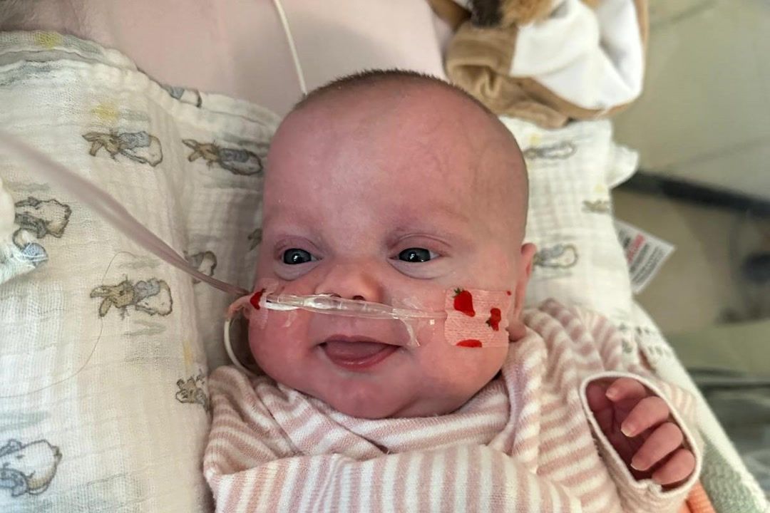 500g premature baby home after keyhole surgery
