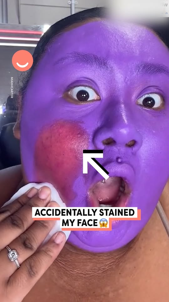 Accidentally stained my entire face