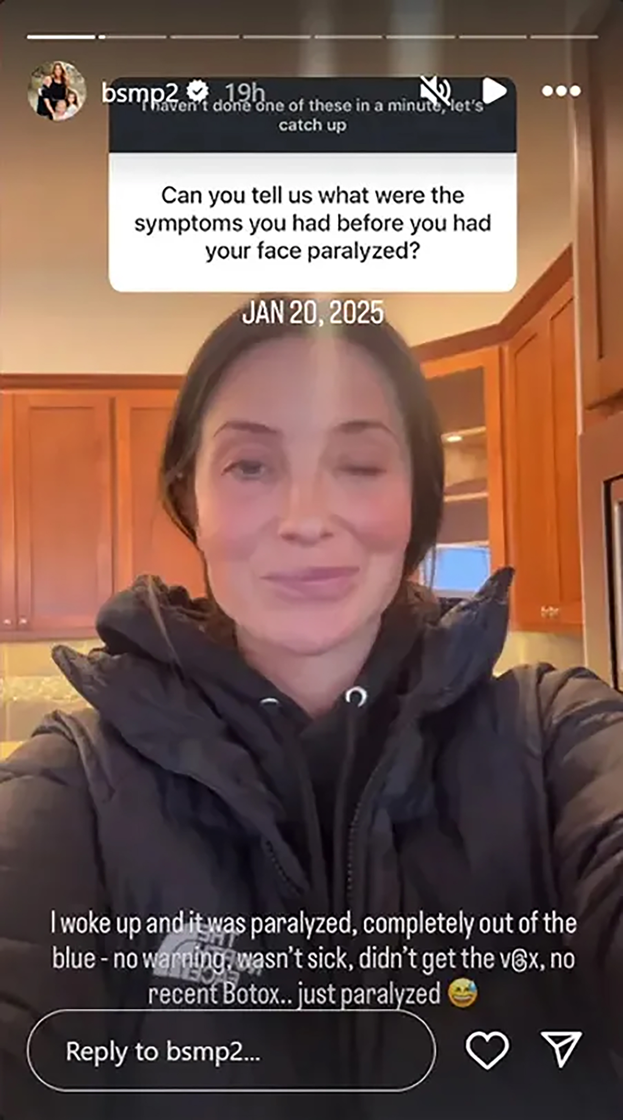 Bristol Palin reveals new plan to fix 'crazy' and 'embarrassing' facial ...