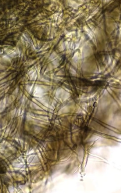 Moldy food up close: Can you safely cut around it?