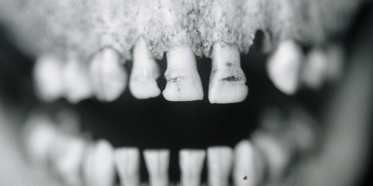 Scientists analyzed teeth and bones from 5,500-year-old burials—and ...