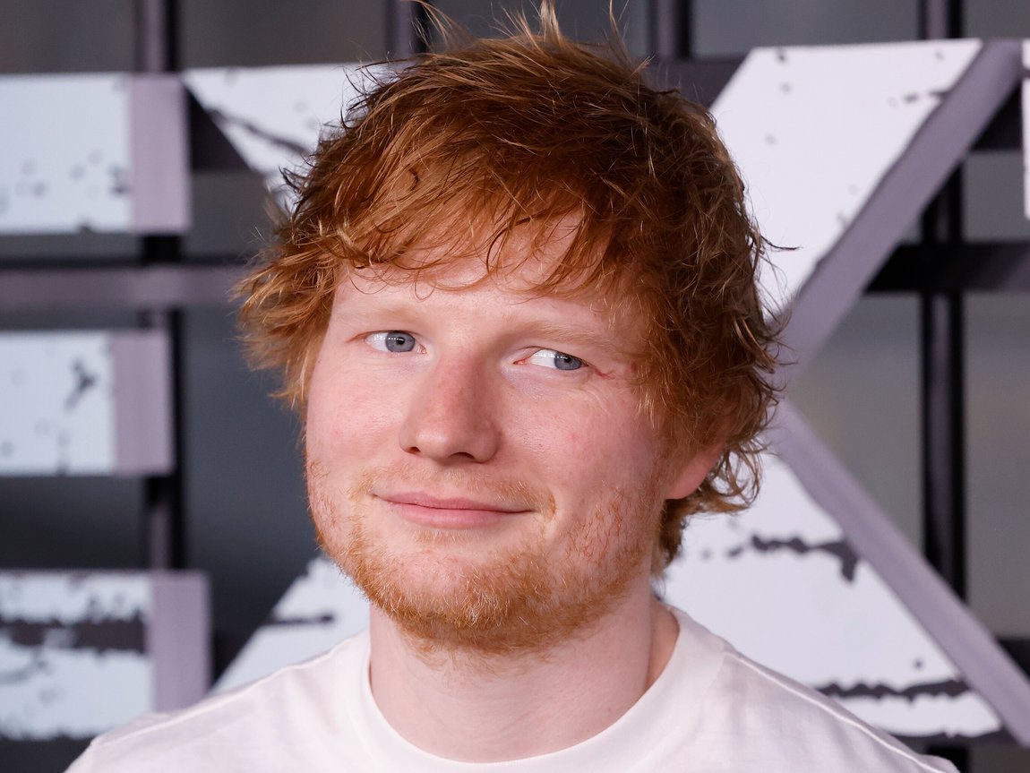 New look: Ed Sheeran shaves his hair off