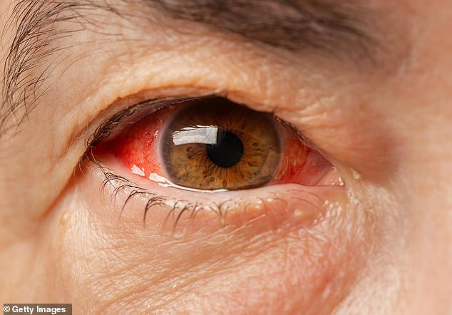 Outbreak panic erupts as deadly eye-bleeding virus ground zero exposed ...