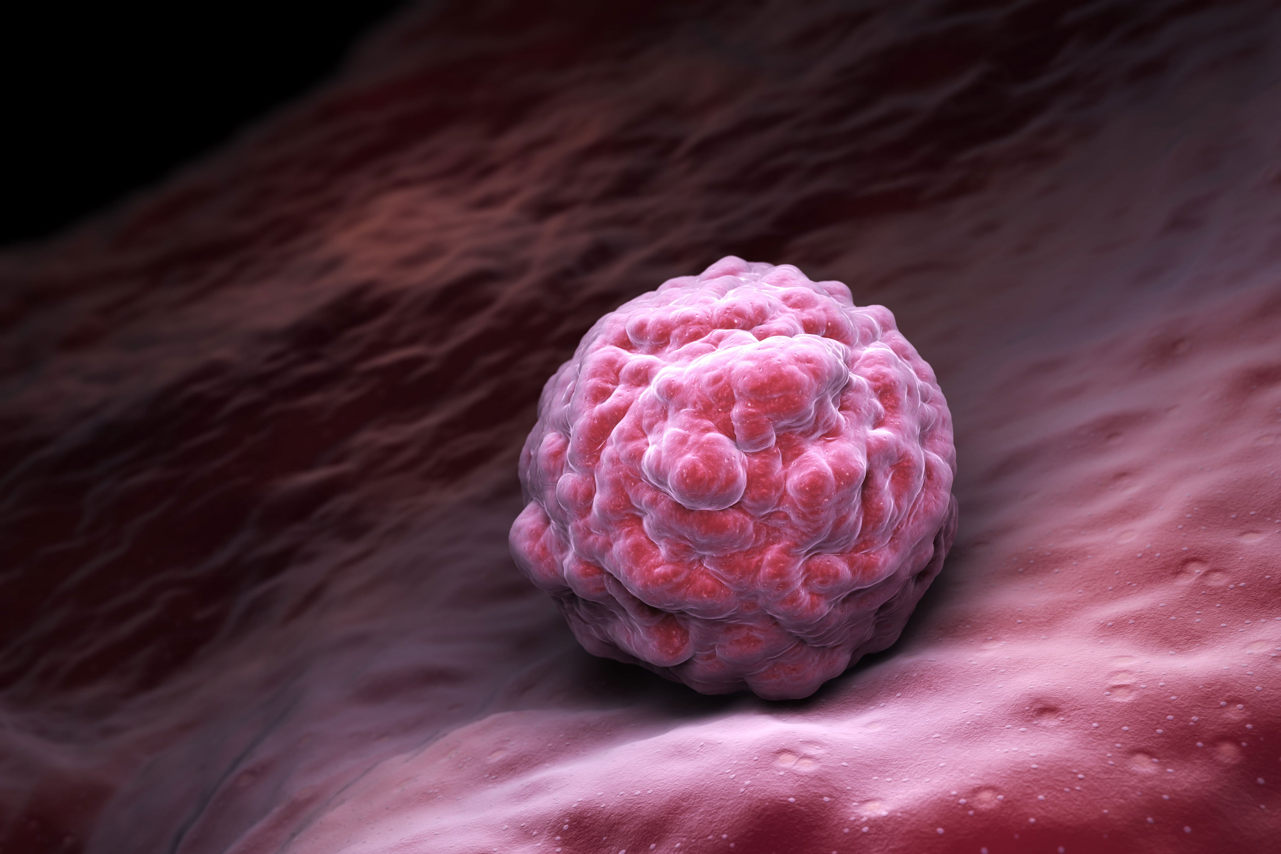 Los dos malos hábitos que más cáncer generan, según la OMS