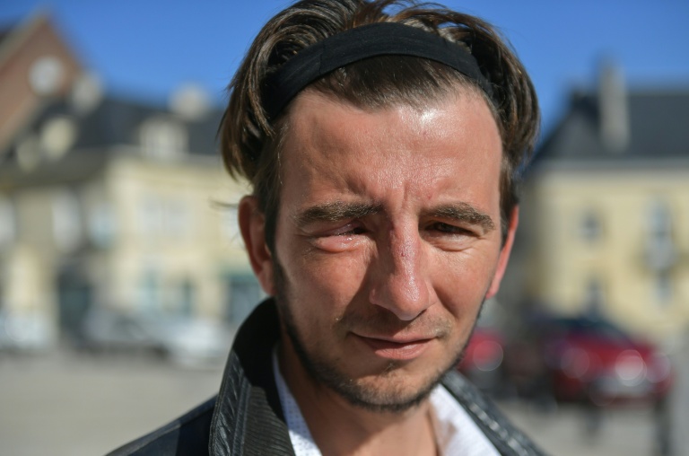 La justice n'est pas du cinéma : l'enquête sur un gilet jaune éborgné ...