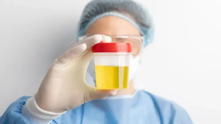 Proteinuria explained: What protein in your urine says about kidney ...