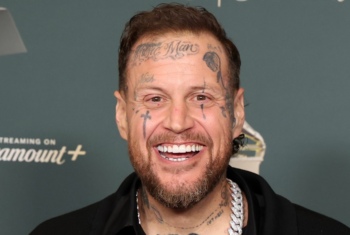 Jelly Roll reveals 'secret' accident that 'snapped his collarbone in half'