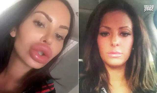 Melbourne nurse's extreme plastic surgery journey: A quest for beauty