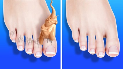 Keep your feet and shoes picture-perfect!💖👡💅