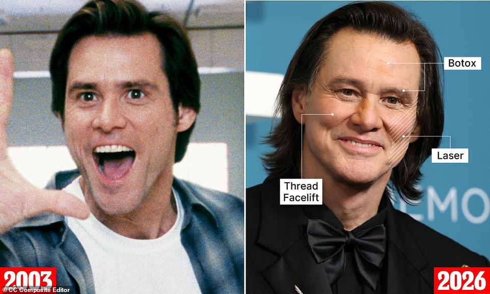 Plastic surgeons weigh in on Jim Carrey's transformation