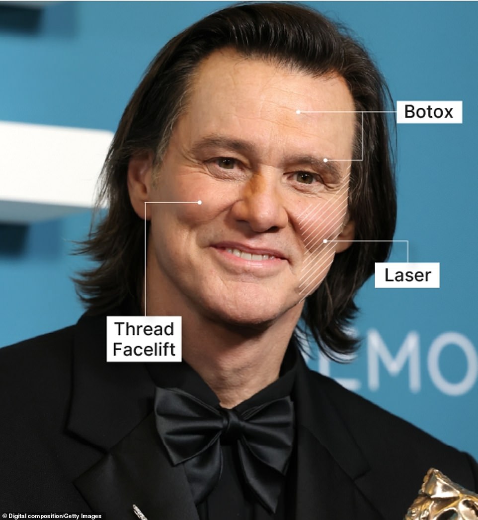 Plastic surgeons weigh in on Jim Carrey's transformation