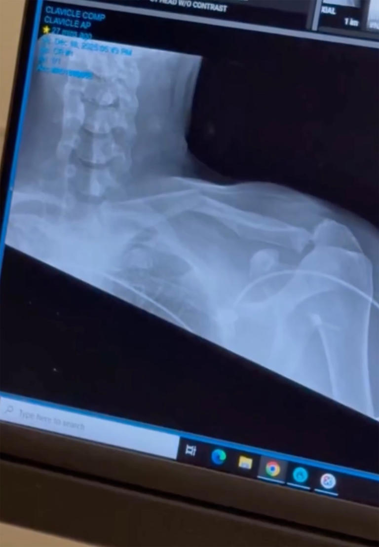 Jelly Roll rushed to hospital after flipping ATV in terrifying crash