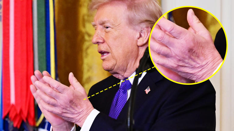 Trump, 79, can’t keep his eyes open at his own meeting