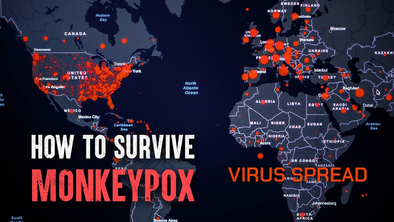 Understanding MPOX and how to stay safe