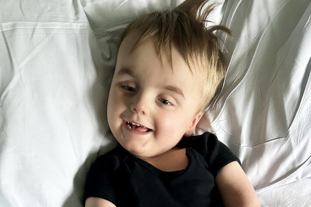 Toddler given world-first diagnosis after secret sign of rare condition ...