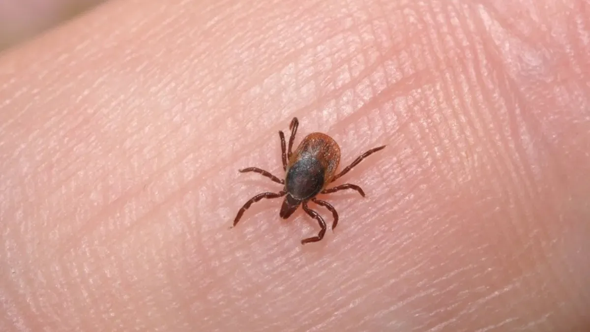 Ensenada: muere niña de 8 años por rickettsiosis tras mordedura de ...