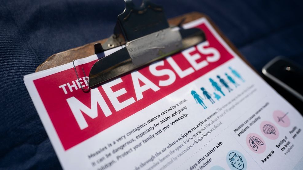 Health officials flag two Salt Lake County locations for measles ...