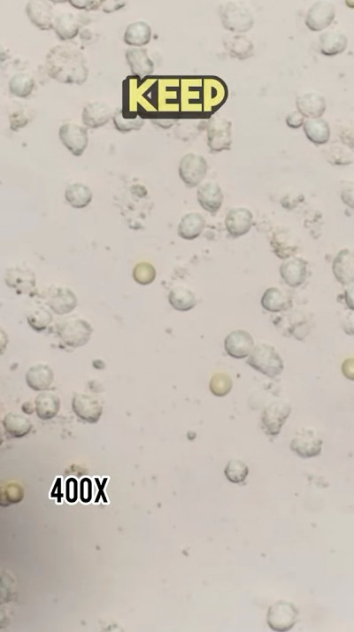 What pimple pus really looks like under a microscope